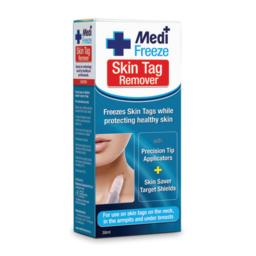 Buy Medi Freeze Skin Tag Remover | Wizard Pharmacy
